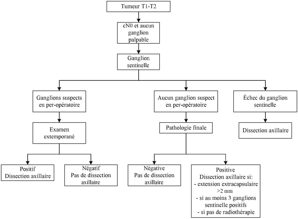 Approche de l’aisselle en cancer du sein - Maladies du sein